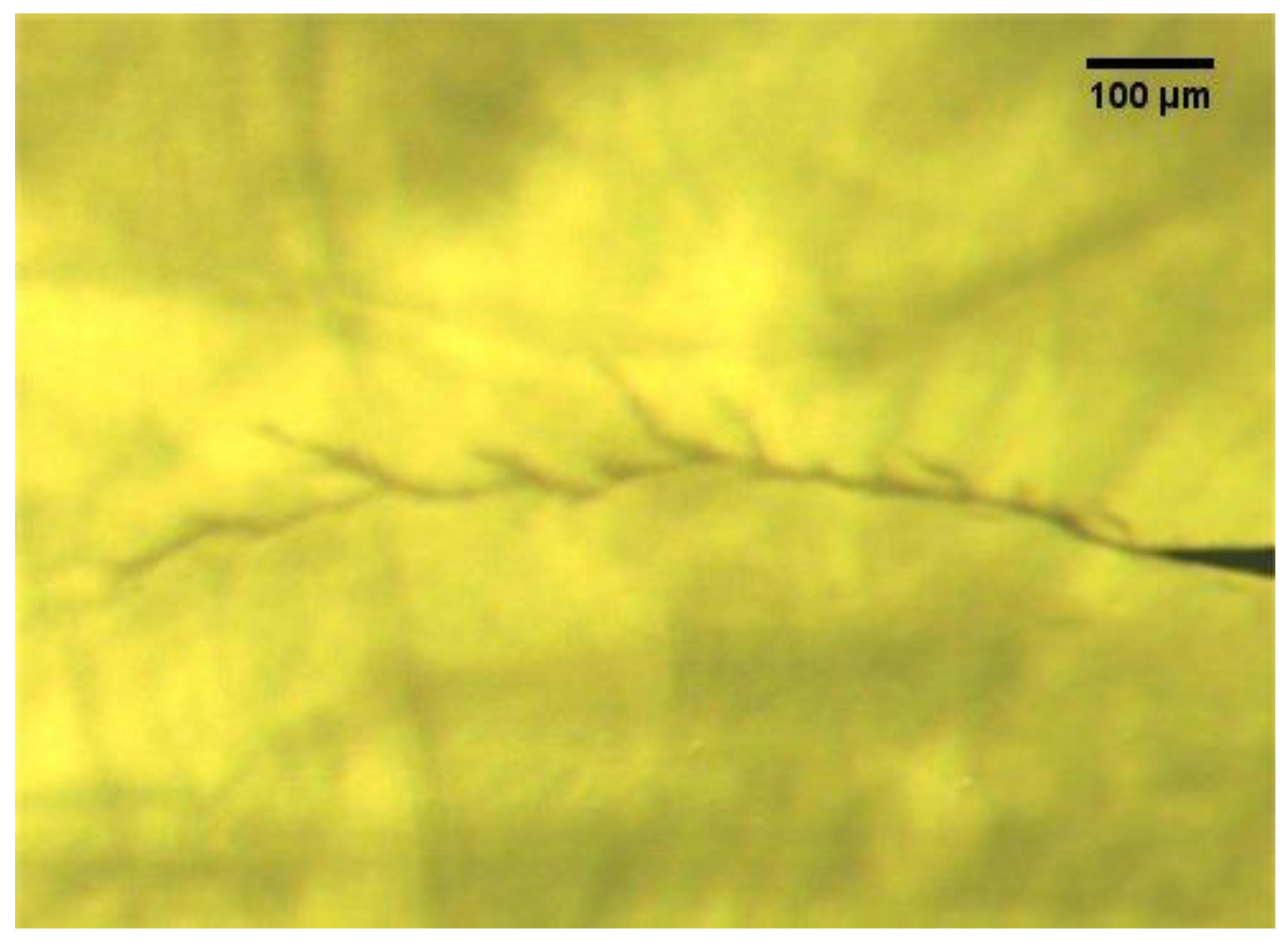 Electrical Treeing in Power Cable Insulation under Harmonics ...