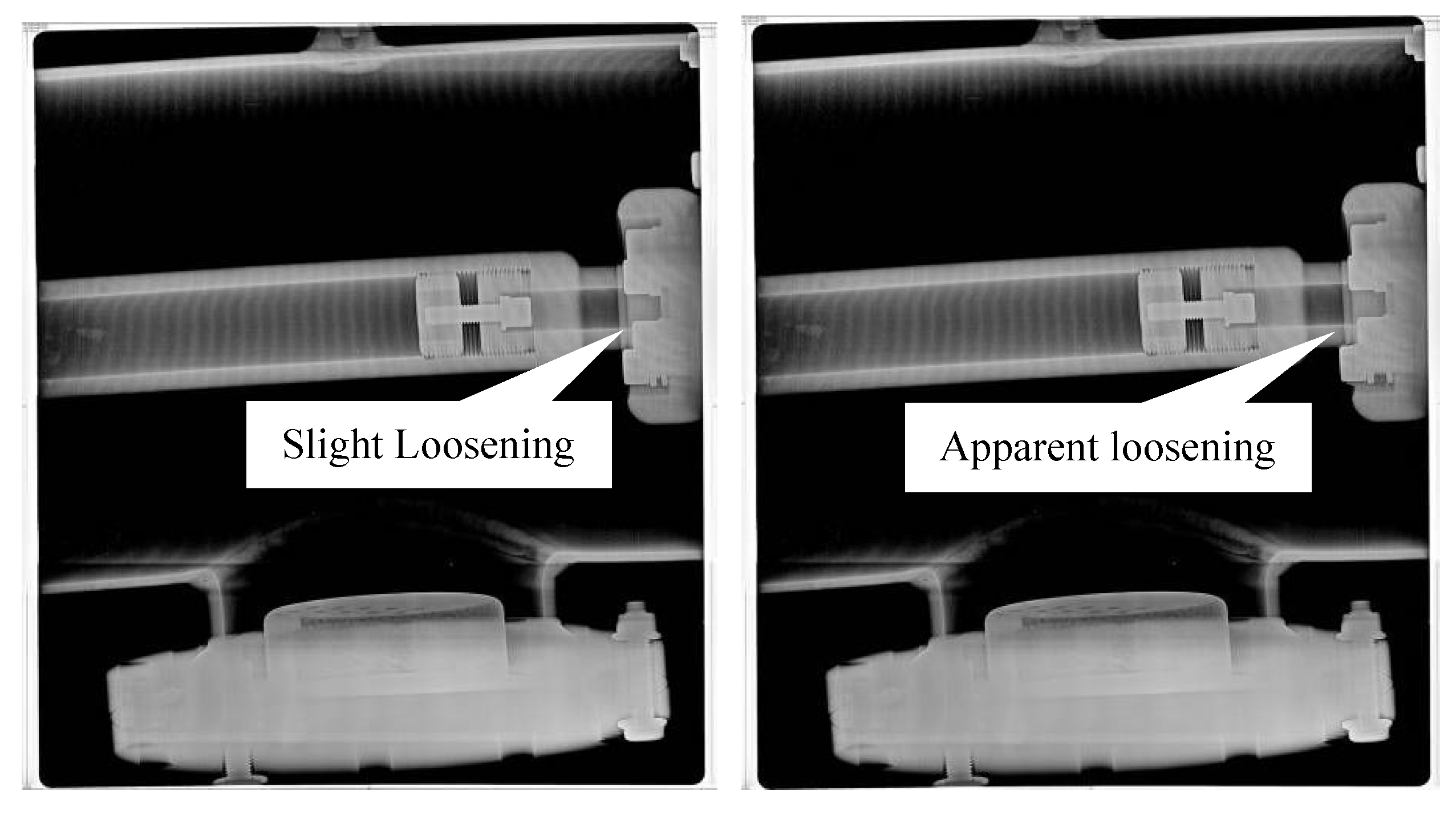 Detection and Diagnosis of Defect in GIS Based on X-ray Digital Imaging ...