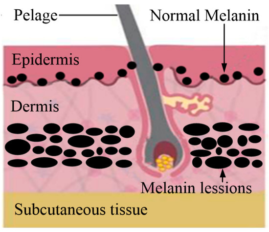 Theoretical Study on Cryogen Spray Cooling in Laser Treatment of Ota’s ...