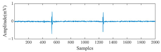 A Novel Denoising Method for Partial Discharge Signal Based on Improved Variational Mode ...