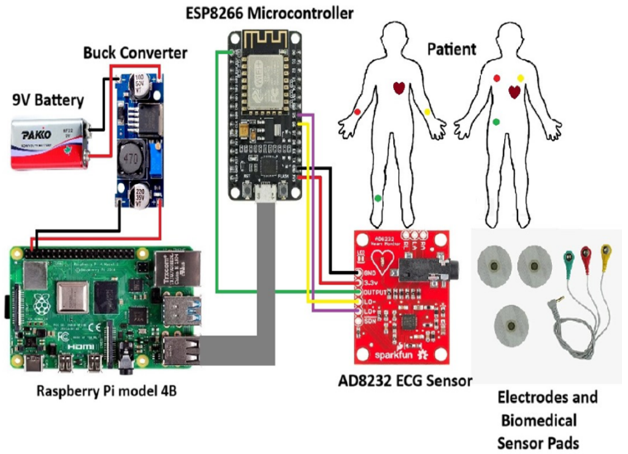 An Embedded System for Real-Time Atrial Fibrillation Diagnosis Using a ...