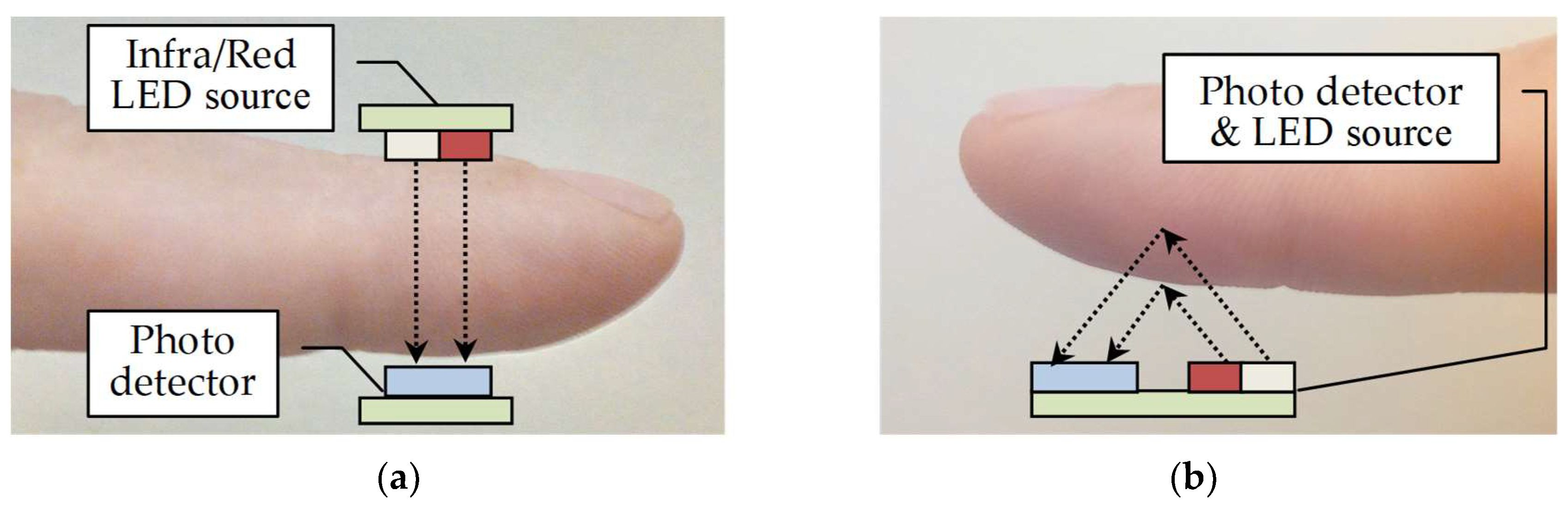 Comparative Measurement of the PPG Signal on Different Human Body ...