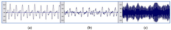 Comparative Measurement of the PPG Signal on Different Human Body ...