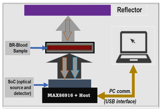 A System-on-Chip Assay for Bilirubin Levels Measurement in Whole Blood