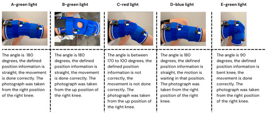 ARC Knee Brace: Neoprene Knee Brace with Active Control Using Wearable ...