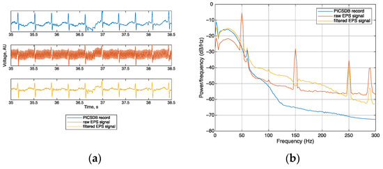 FPGA Implementation of ECG Signal Processing for Use in a Neonatal ...