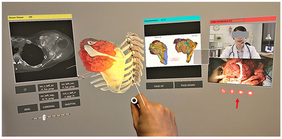 Hologram Opens a New Learning Door for Surgical Residents—An Academic ...