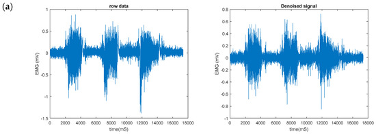Types of EMG Textile Electrodes: A Comparative Study Using PCA