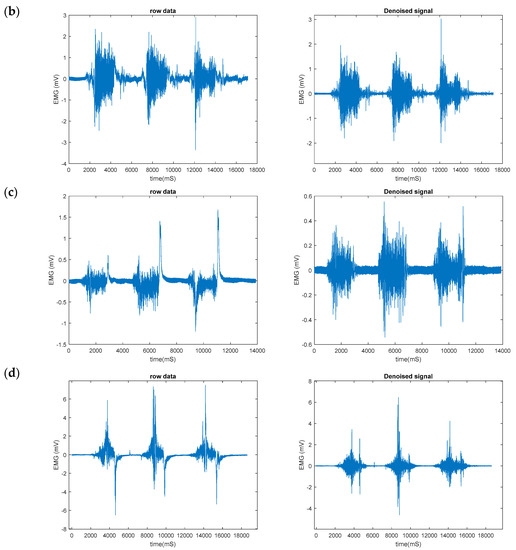 Types of EMG Textile Electrodes: A Comparative Study Using PCA