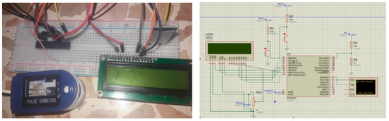 Non-Invasive IR-Based Measurement of Human Blood Glucose