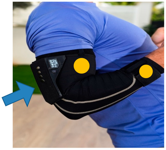 Case Study: Using Healables® ElectroGear® Wearable E-Textile Sleeve ...