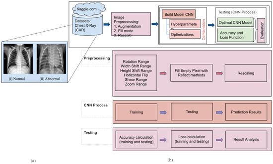 Detection of Chest X-ray Abnormalities Using CNN Based on Hyperparameter Optimization