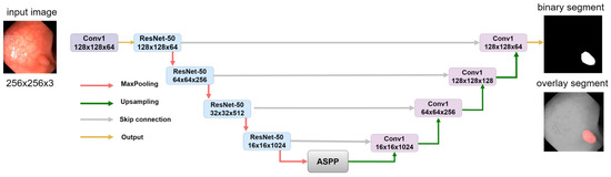Modification of U-Net with Pre-Trained ResNet-50 and Atrous Block for Polyp Segmentation: Model ...