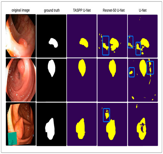 Modification of U-Net with Pre-Trained ResNet-50 and Atrous Block for ...