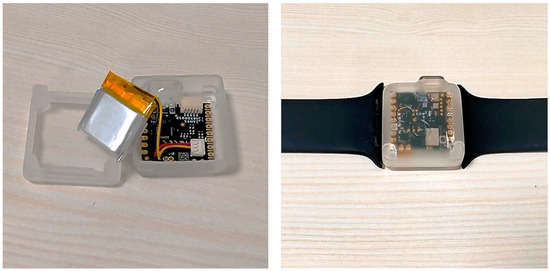 A TinyML Approach to Real-Time Snoring Detection in Resource ...