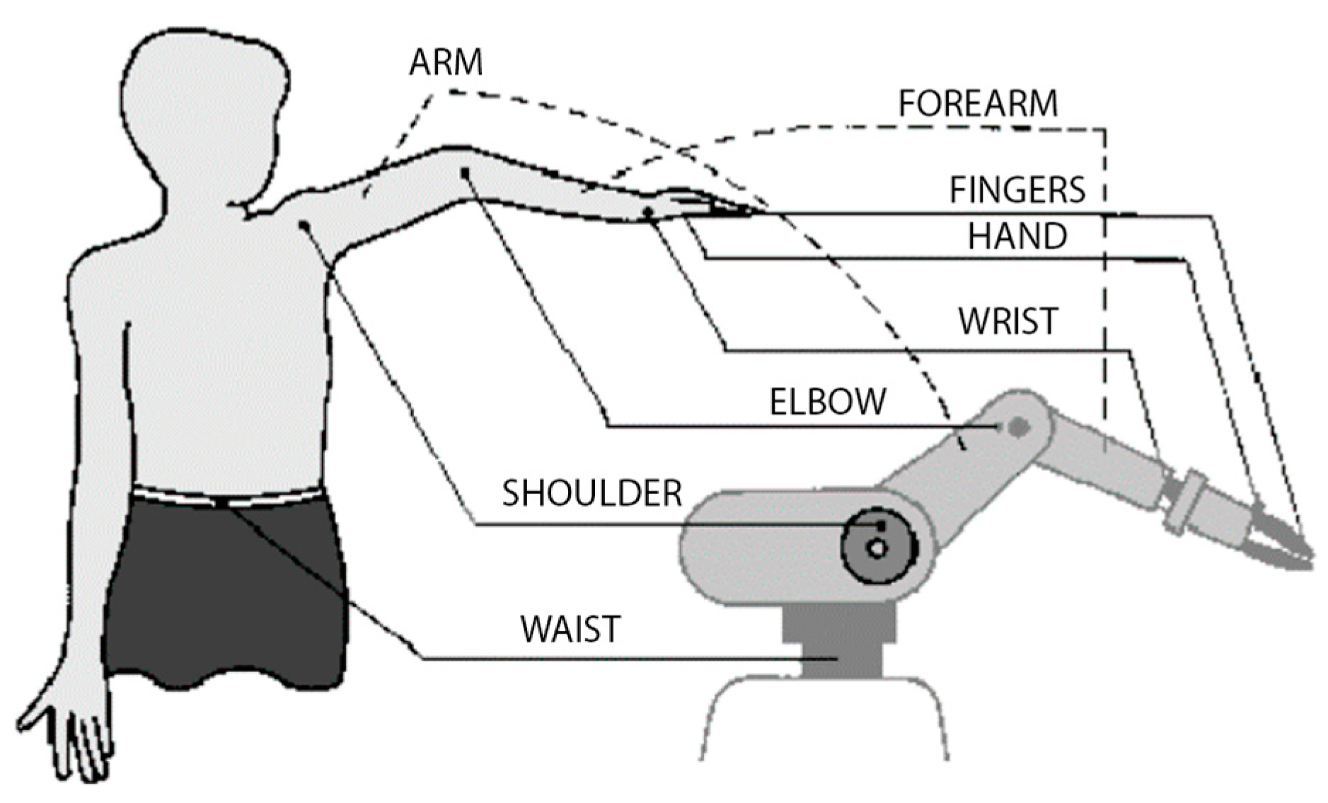 Articulated Robotic Arm for Minimally Invasive Stereotactic ...