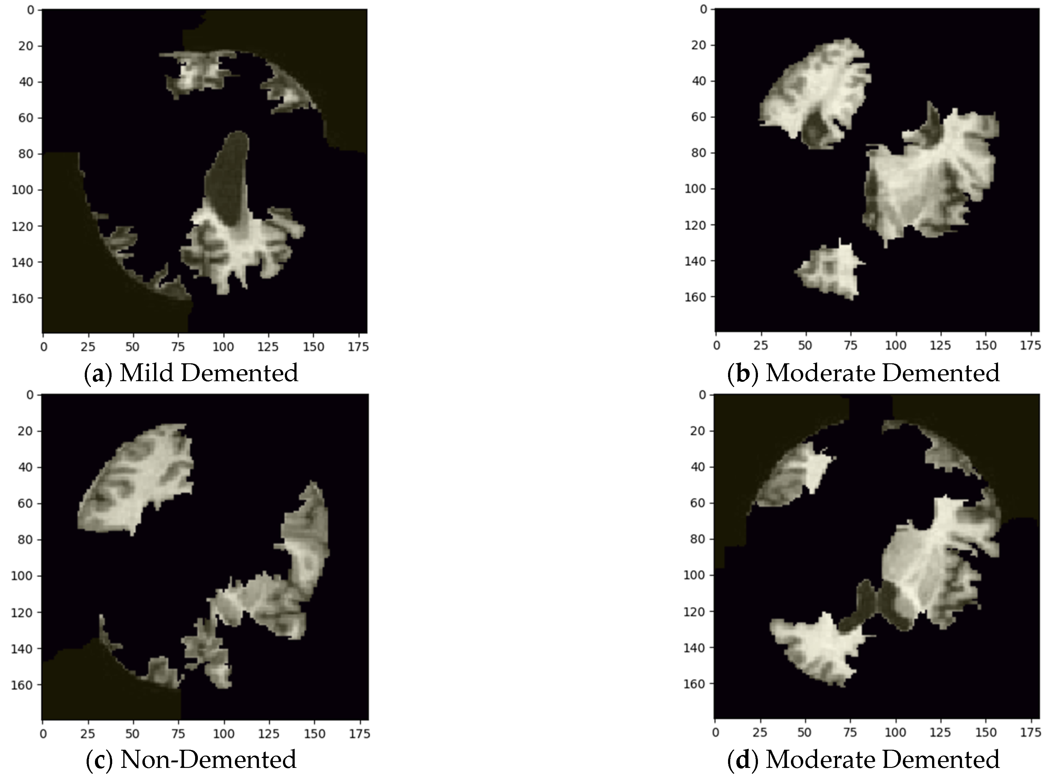 A Custom Convolutional Neural Network Model-Based Bioimaging Technique for Enhanced Accuracy of ...