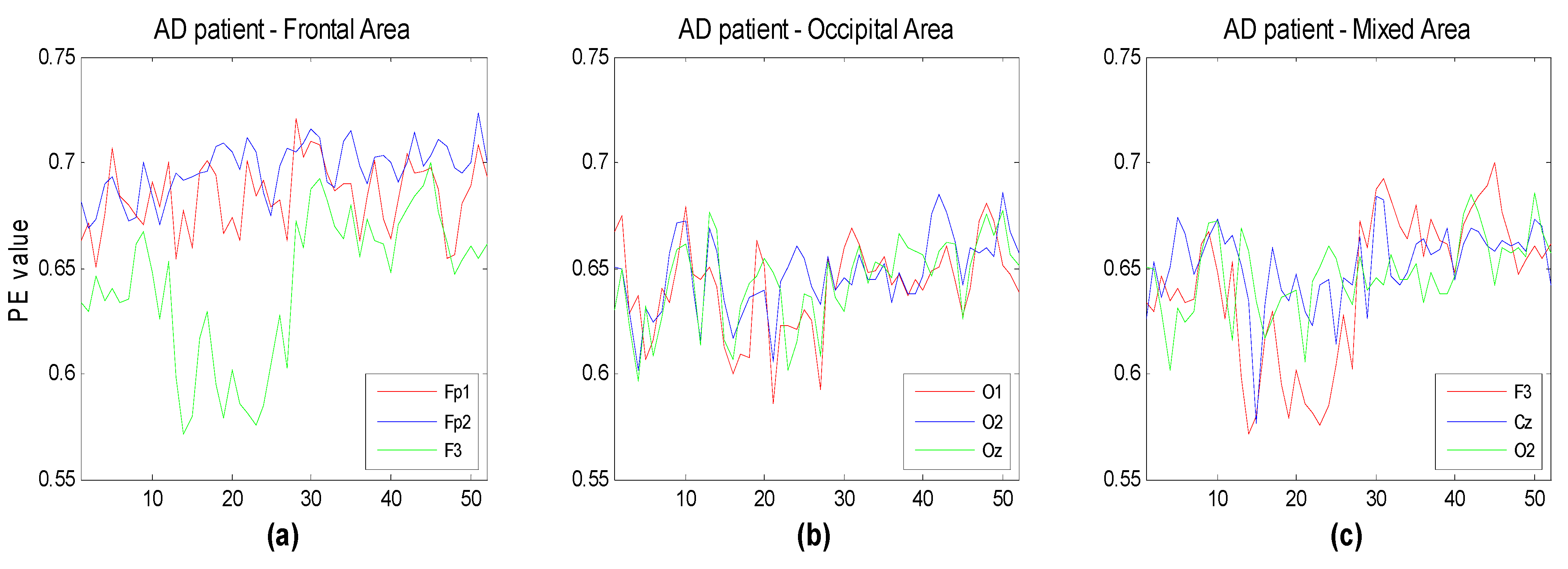 Multivariate Multi-Scale Permutation Entropy for Complexity Analysis of Alzheimer’s Disease EEG