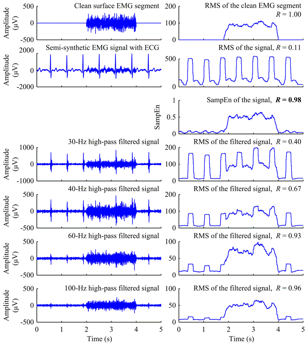 Complexity Analysis of Surface EMG for Overcoming ECG Interference ...