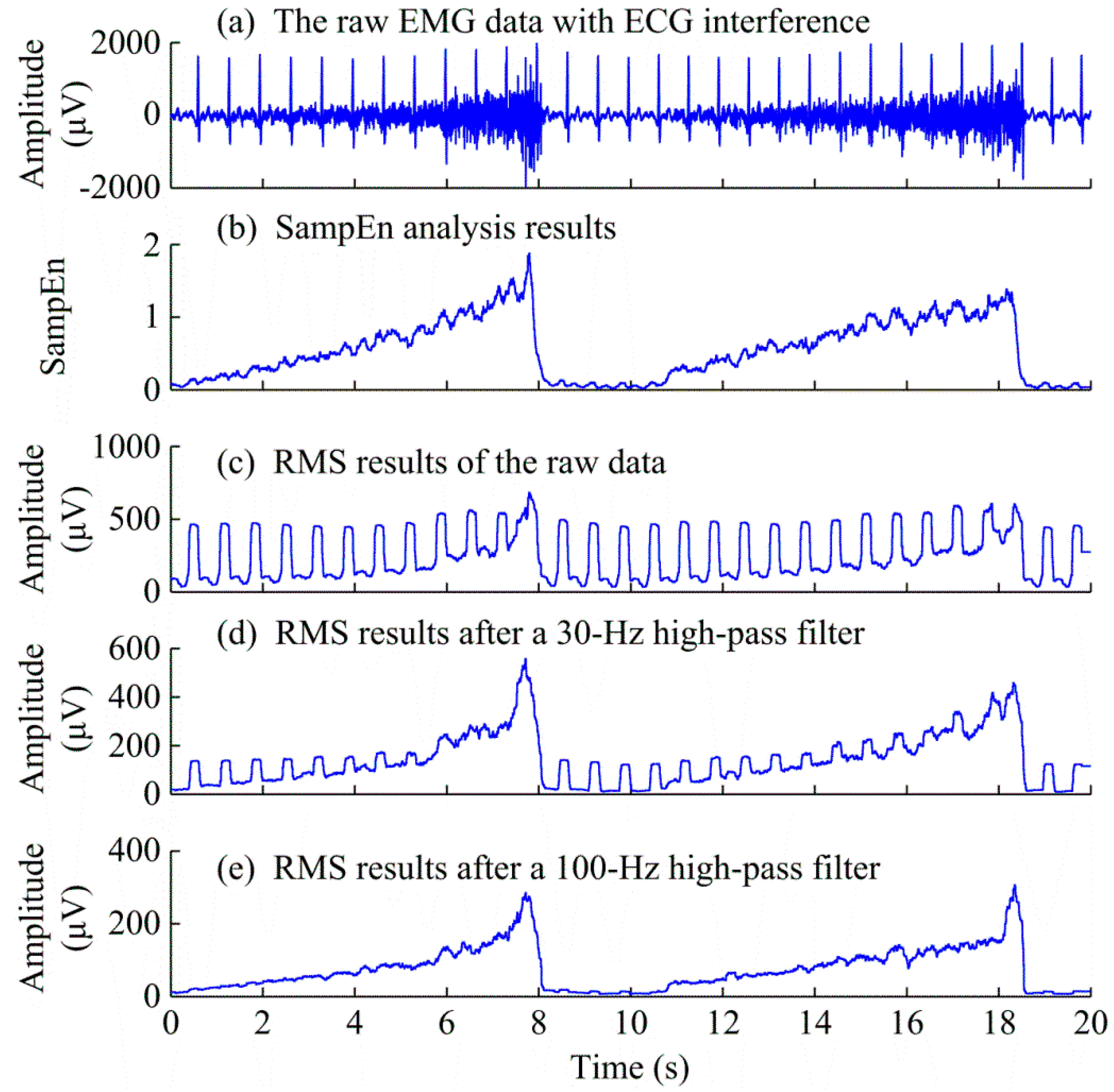Complexity Analysis of Surface EMG for Overcoming ECG Interference ...