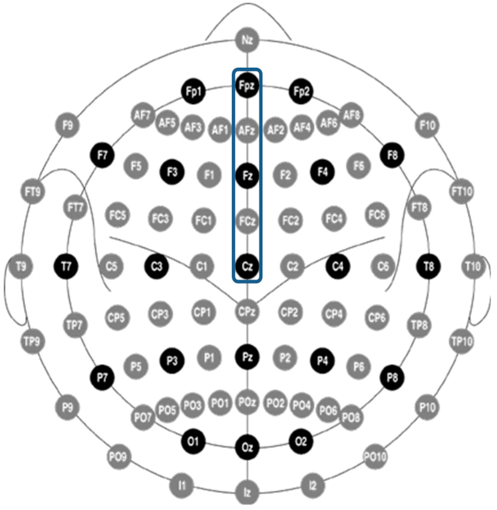 Sleep Stage Classification Using EEG Signal Analysis: A Comprehensive ...
