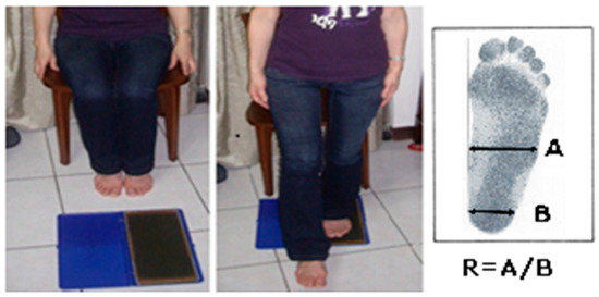A Comparison of Postural Stability during Upright Standing between ...