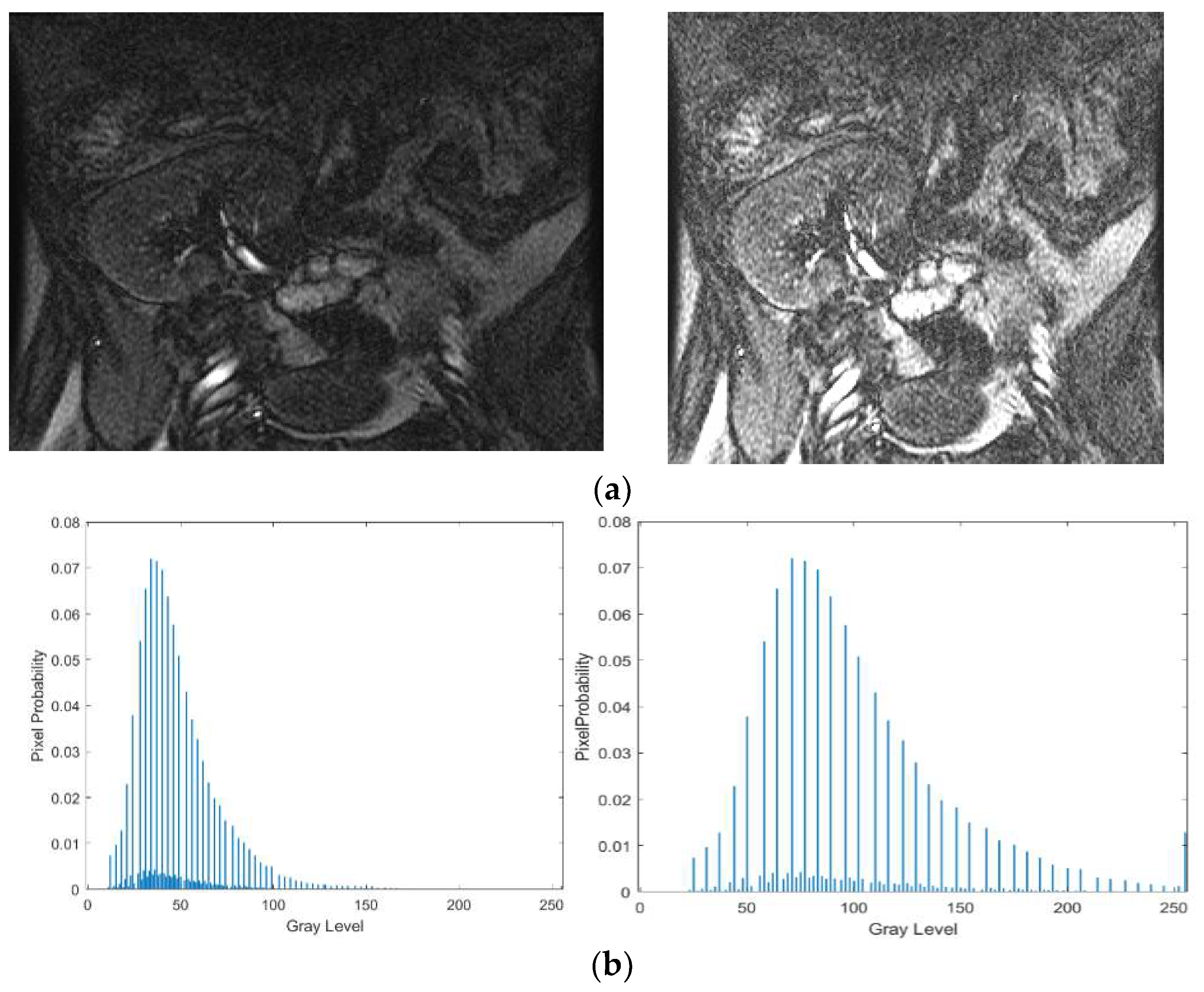 Entropy Free Full Text A New Local Fractional Entropy Based Model
