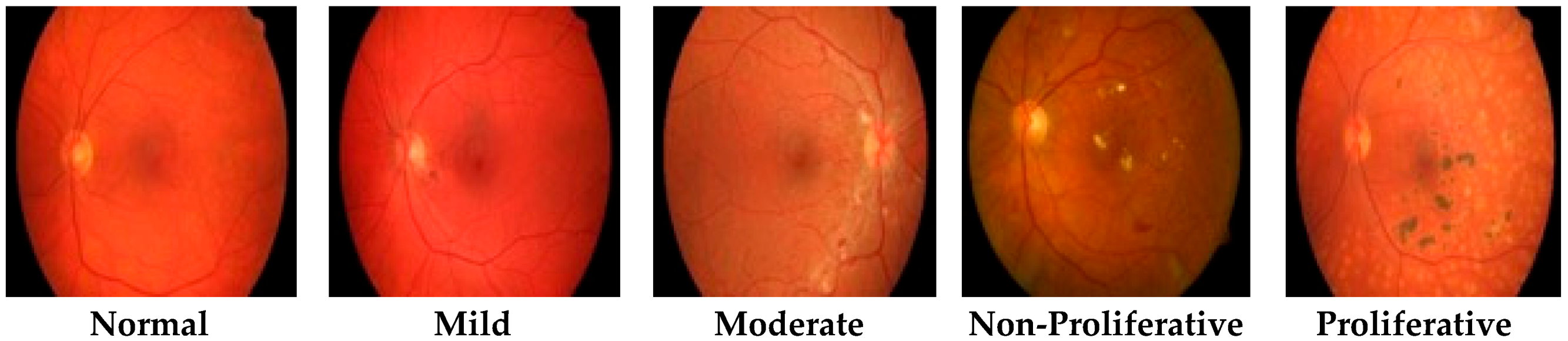 Machine Learning Based Automated Segmentation and Hybrid Feature ...