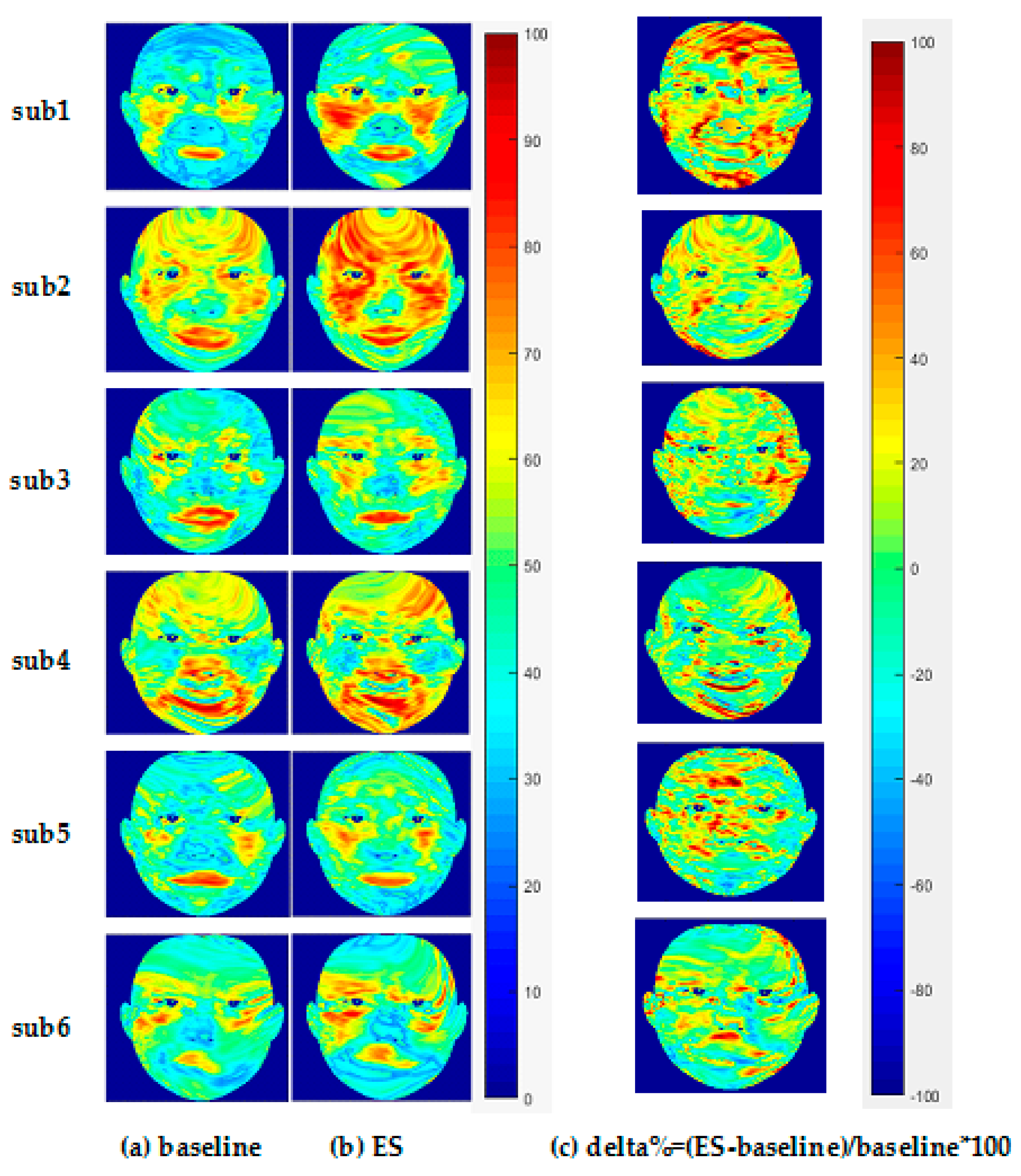 Human Stress and StO2: Database, Features, and Classification of ...