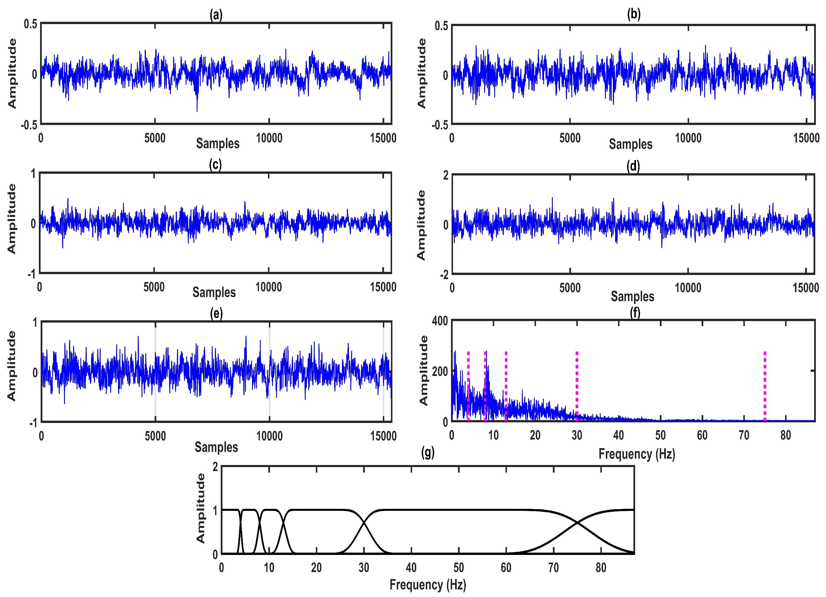Development of Automated Sleep Stage Classification System Using Multivariate Projection-Based ...