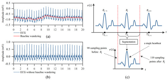 Automatic Ecg Classification Using Continuous Wavelet Transform And Convolutional Neural Network