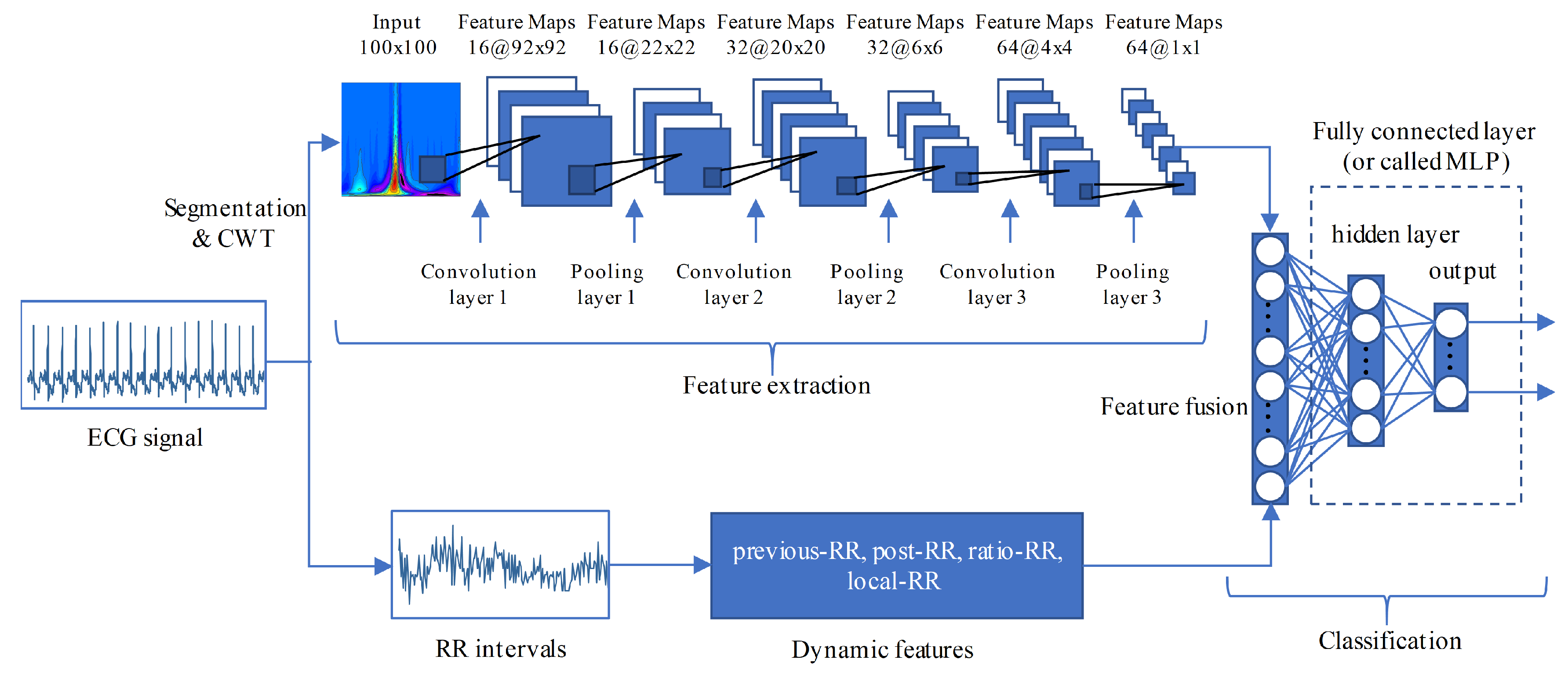 Entropy Free Full Text Automatic Ecg Classification Using Continuous Wavelet Transform And