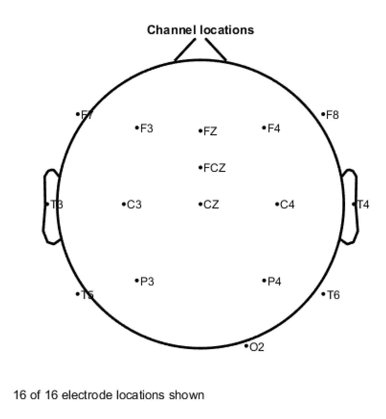 Research on Channel Selection and Multi-Feature Fusion of EEG Signals ...