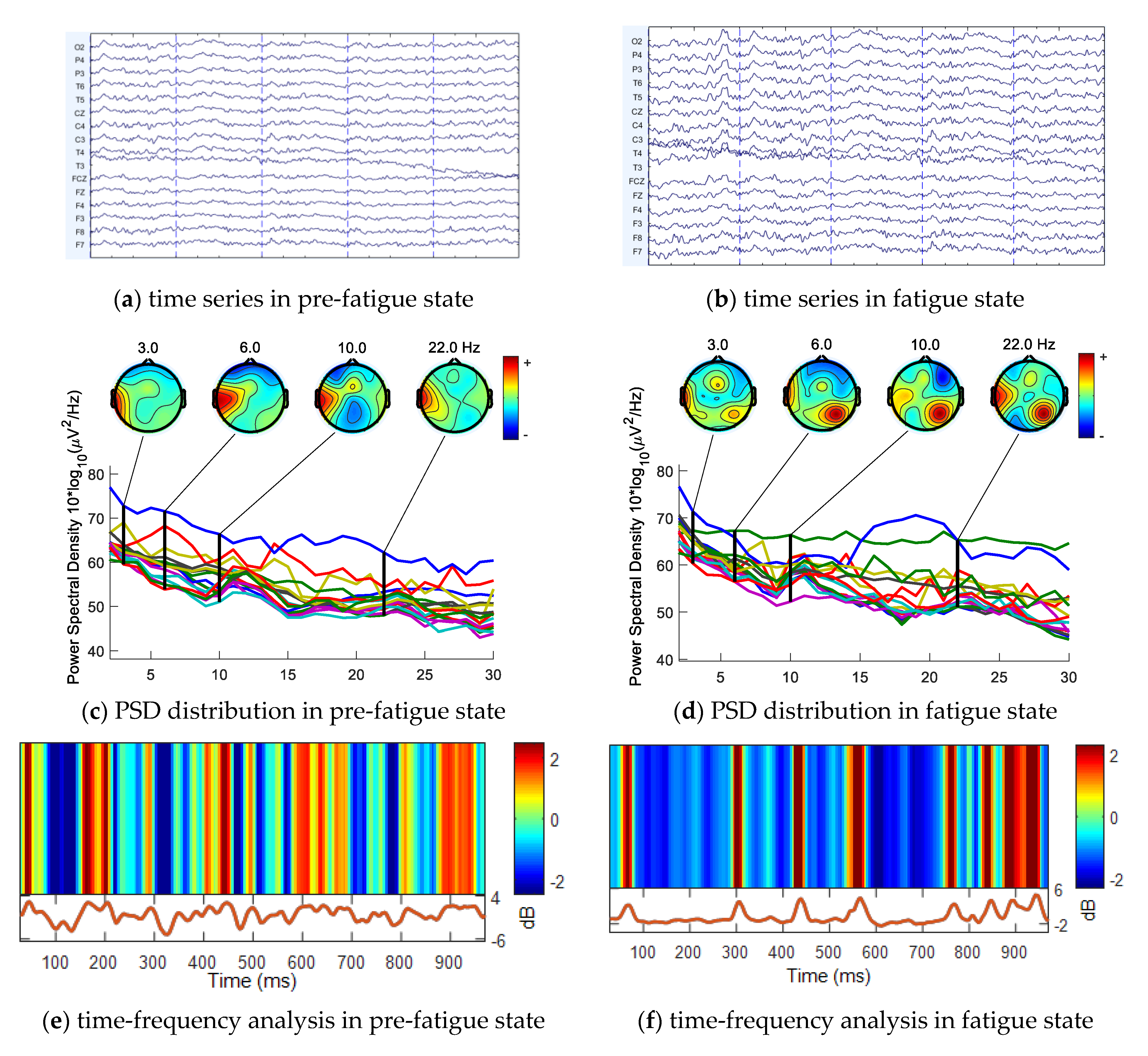 Research on Channel Selection and Multi-Feature Fusion of EEG Signals ...