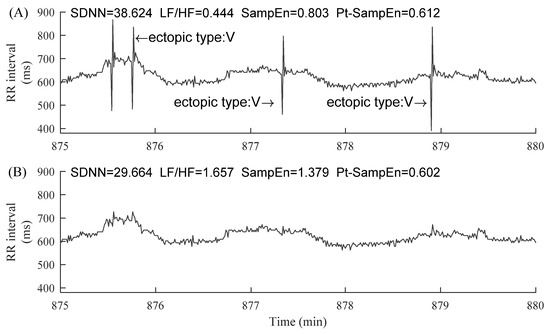 Entropy Special Issue Multiscale Entropy Approaches And Their Applications Ii