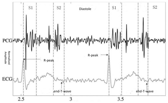 Entropy | Free Full-Text | Deep Learning Methods for Heart Sounds ...