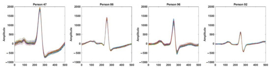 Using Convolutional Neural Network and a Single Heartbeat for ECG ...