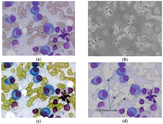 Entropy | Free Full-Text | Instance Segmentation of Multiple Myeloma Cells Using Deep-Wise Data ...