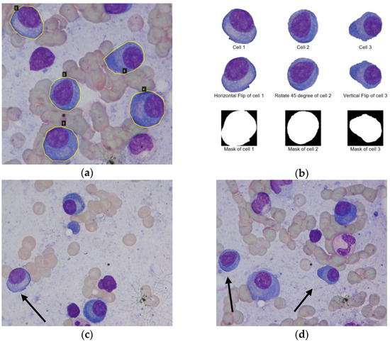 Entropy | Free Full-Text | Instance Segmentation of Multiple Myeloma Cells Using Deep-Wise Data ...