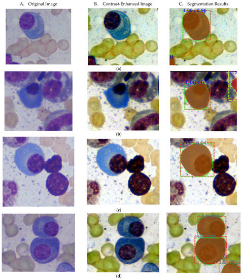 Entropy | Free Full-Text | Instance Segmentation of Multiple Myeloma Cells Using Deep-Wise Data ...