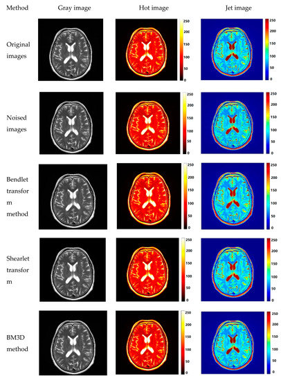 Bendlet Transform Based Adaptive Denoising Method for Microsection Images