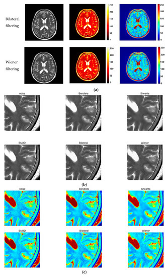 Bendlet Transform Based Adaptive Denoising Method for Microsection Images