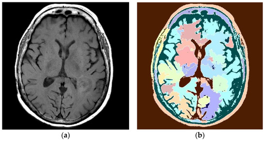 Bendlet Transform Based Adaptive Denoising Method for Microsection Images