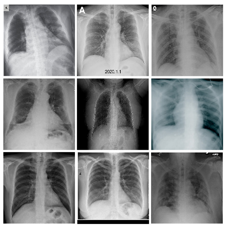 Lossless Medical Image Compression by Using Difference Transform