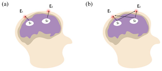 Directed Brain Network Analysis for Fatigue Driving Based on EEG Source ...
