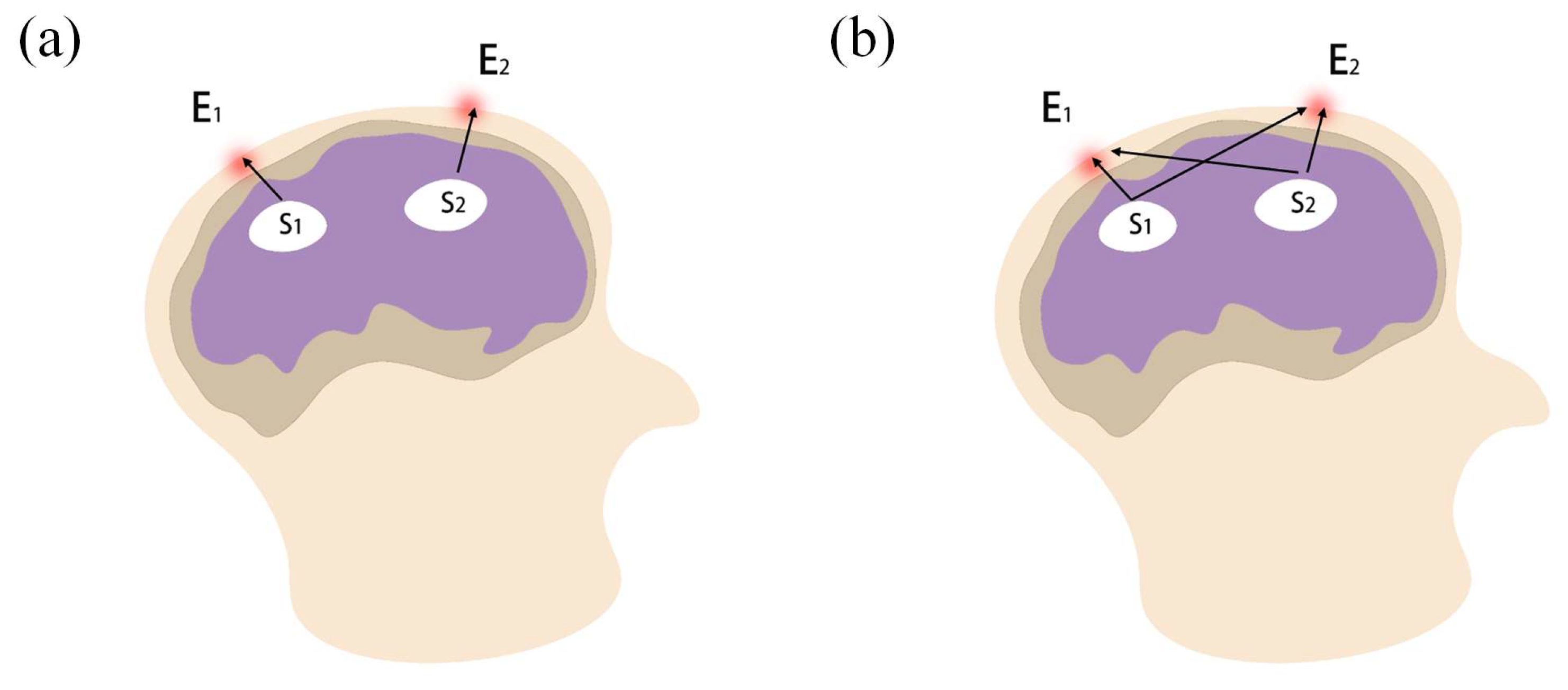 Directed Brain Network Analysis for Fatigue Driving Based on EEG Source ...