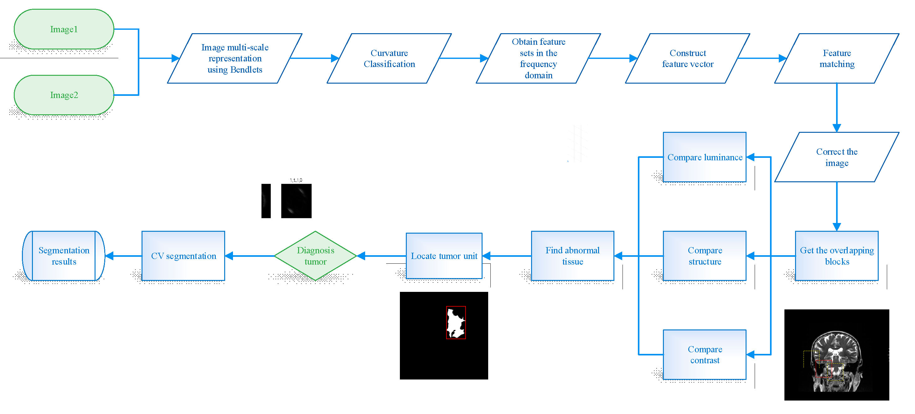 Entropy | Free Full-Text | Brain Tumor Segmentation Based on Bendlet Transform and Improved Chan ...
