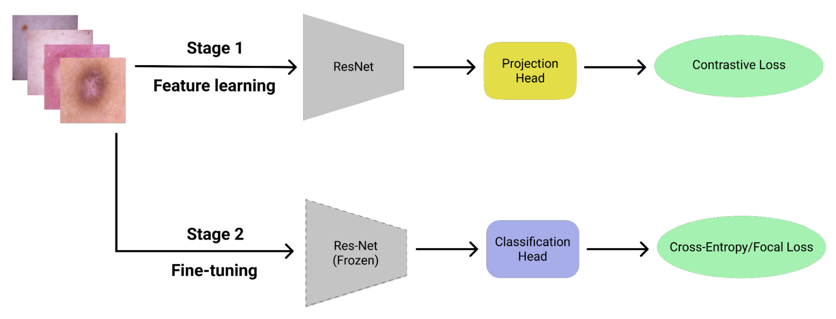 An Asymmetric Contrastive Loss for Handling Imbalanced Datasets