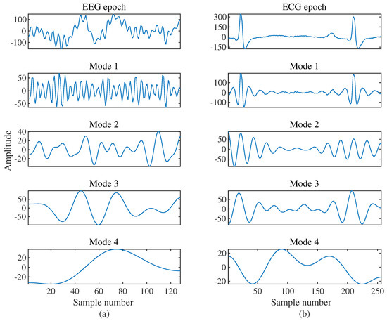 Automated Emotion Identification Using Fourier–Bessel Domain-Based Entropies