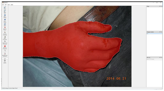 A Spiking Neural Network Based on Retinal Ganglion Cells for Automatic ...